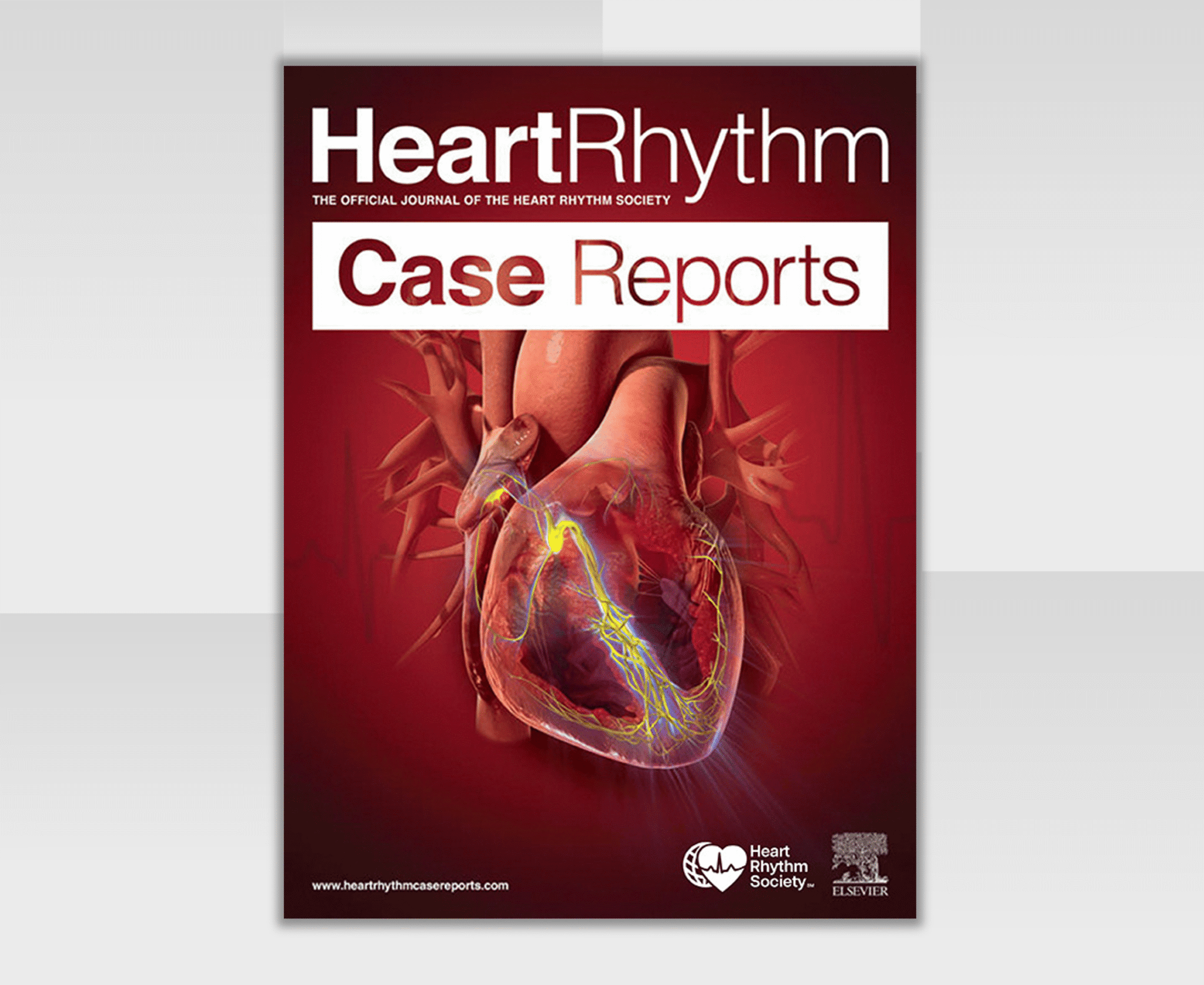 Heart Rhythm Case Reports - HRS